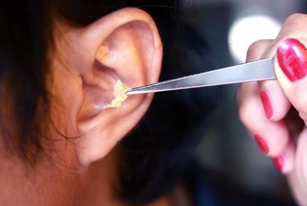 Understanding the Anatomy of the Ear - Insider Paper